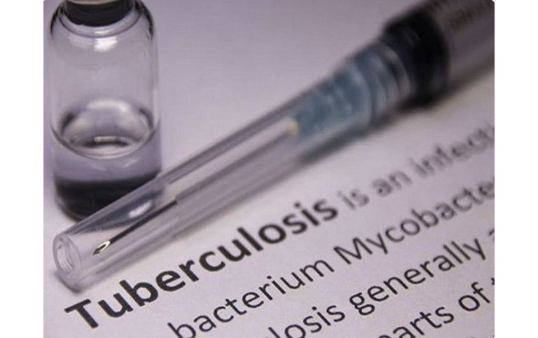 Tuberculosis cases surged for the first time in many years: WHO - The ...